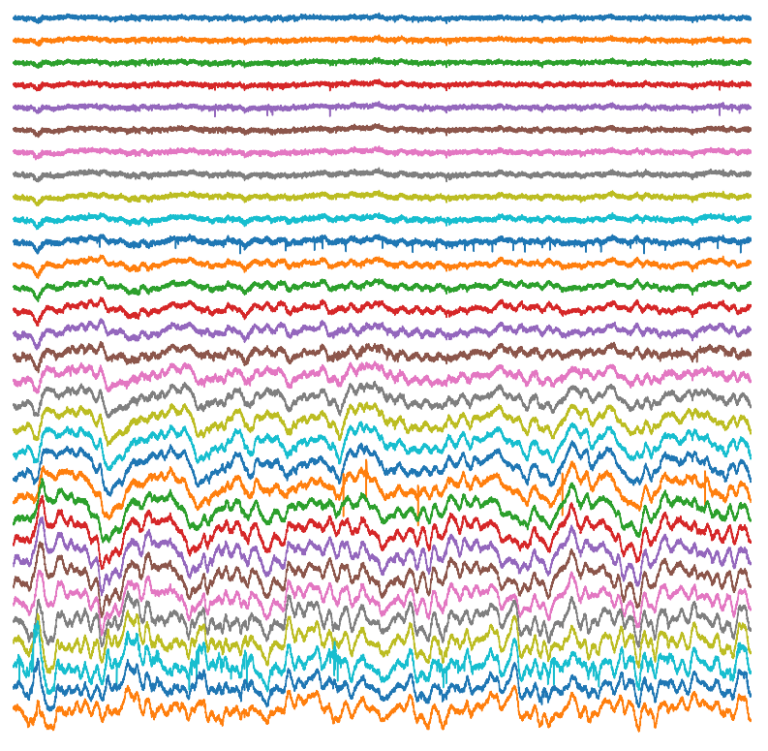 Multi Electrode Array Recording Soltesz Lab