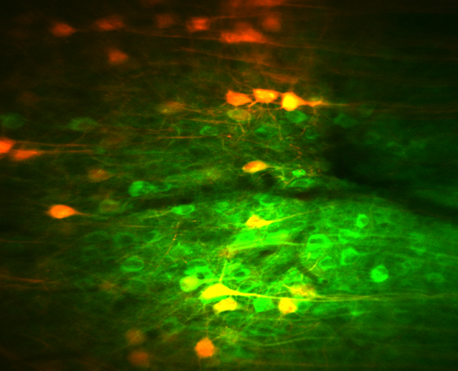In-vivo Calcium Imaging – Soltesz Lab